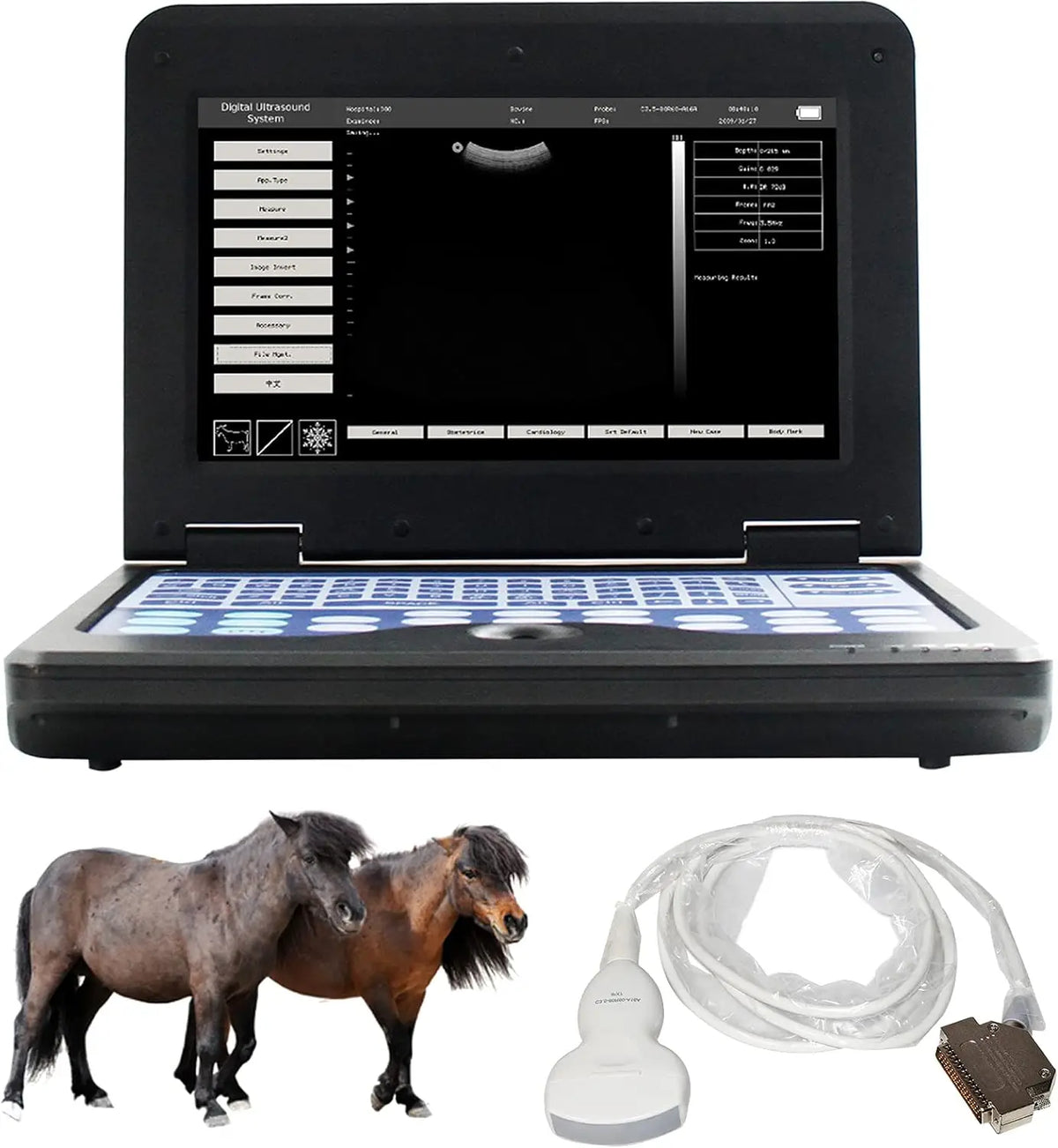 Portable Ultrasound Machine — Meubon