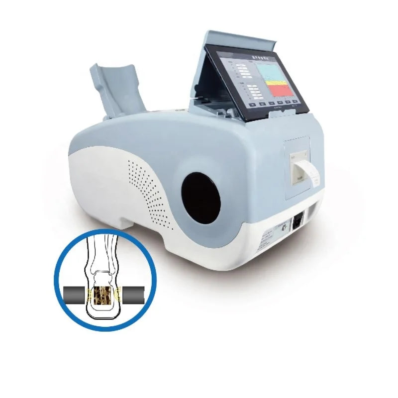 Ultrasound Bone Densitometer - Automatic Bone Density Scan Machine for ...