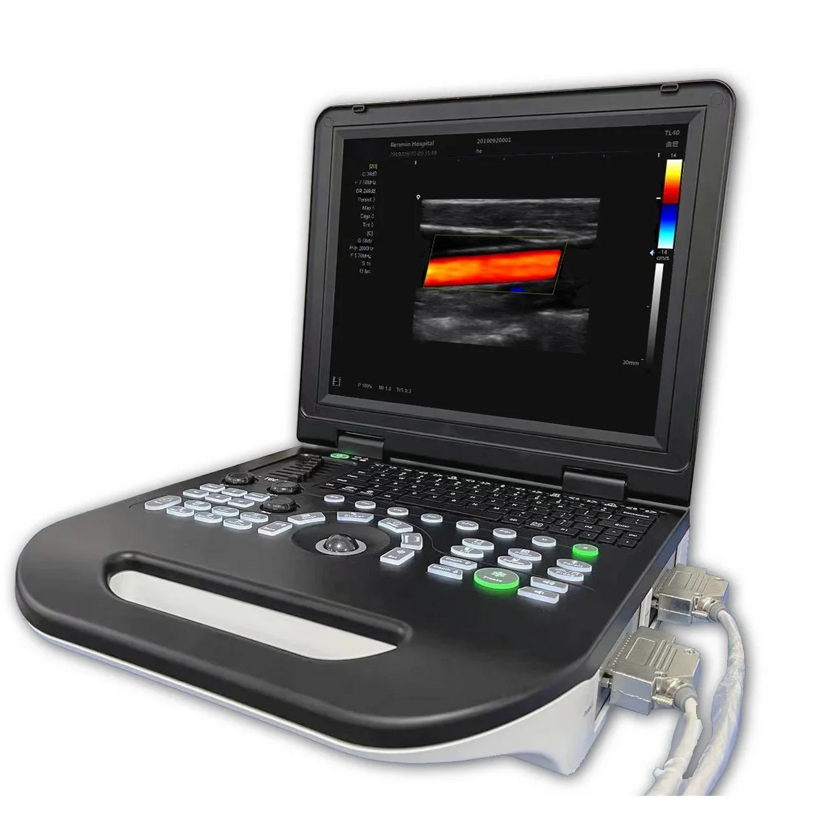 Portable 3D Color Doppler Ultrasound Machine – Laptop Hospital-Grade D ...
