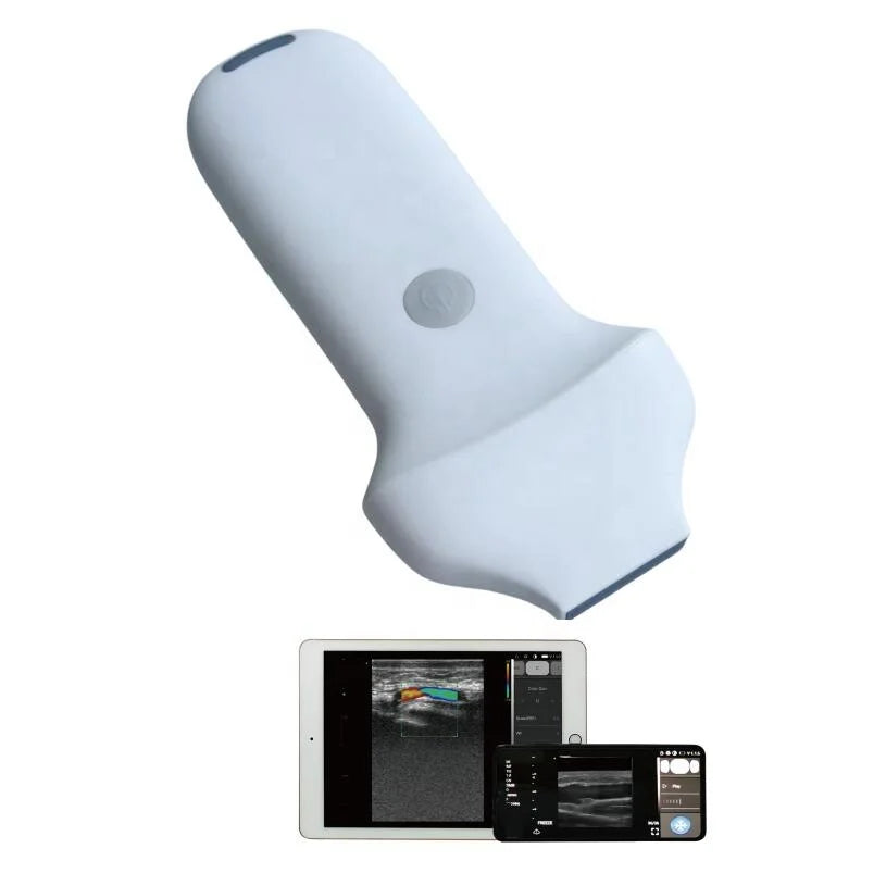 20MHz Linear Wireless Ultrasound Probe – Handheld Diagnostic Scanner ...