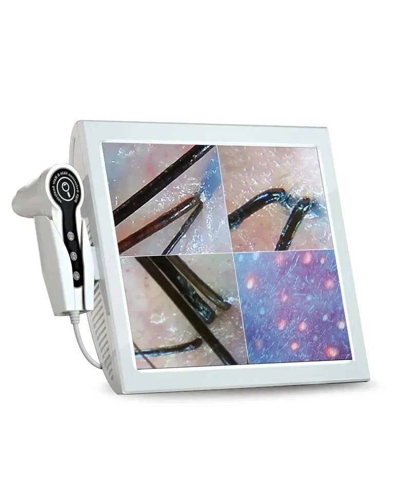 Meubon HD Digital Skin Analyzer & Hair Scalp Camera – Professional 15-