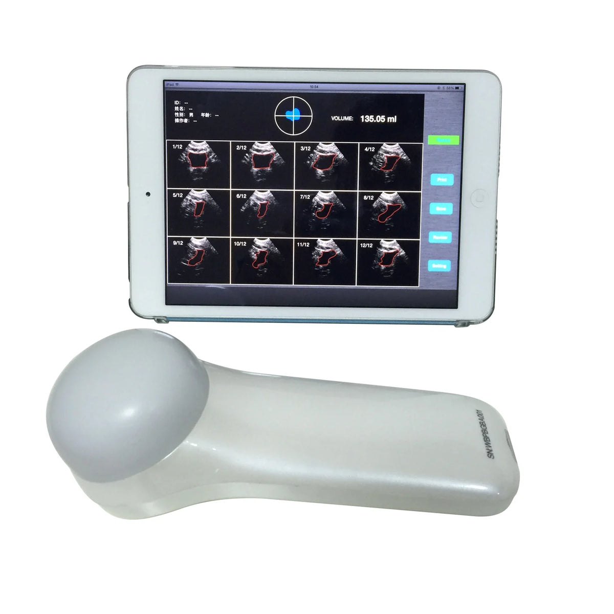 4D Wireless Bladder Scanner Bladder ultrasound – Meubon