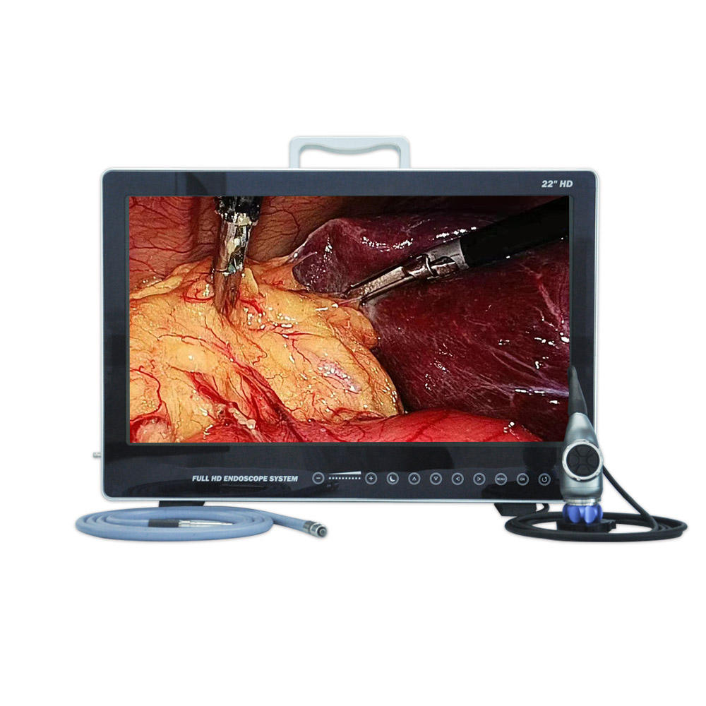 Portable All in One HD Endoscope Camera for ENT/Laparoscopy/Hysterosco ...