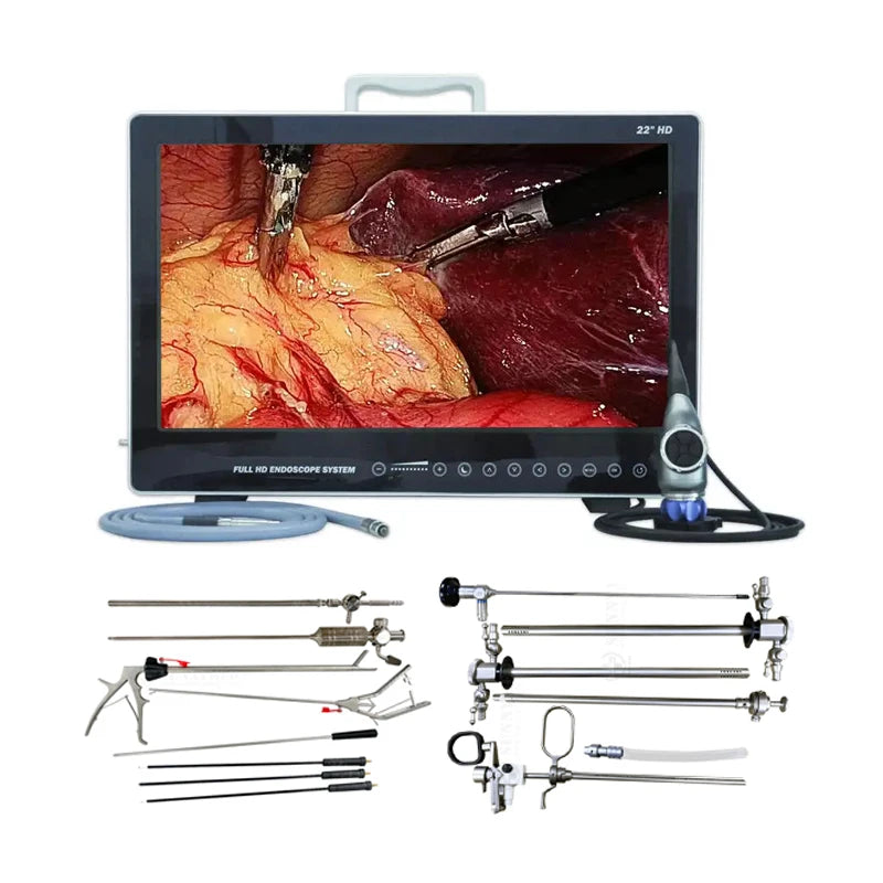 Surgery HD Endoscope Camera System I All-in-One Solution for Laparosco ...