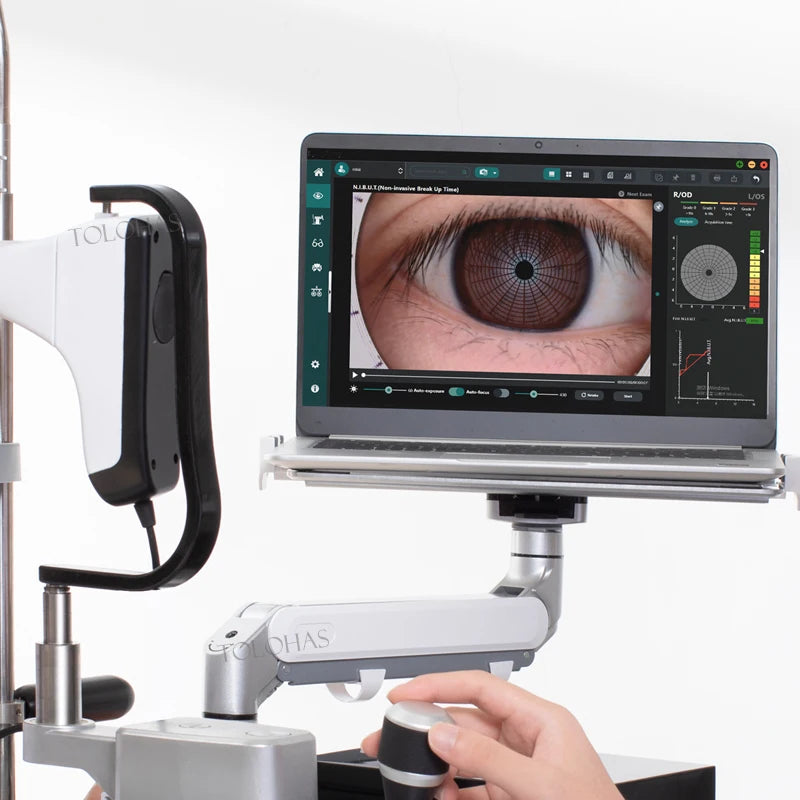 Medical Dry Eye Analyzer Machine I Ophthalmic Examination Integrated D ...