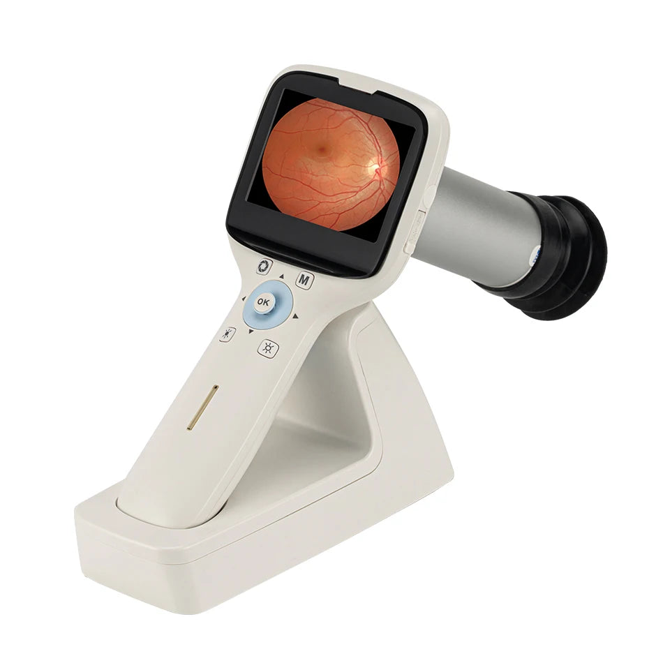 High Definition Handheld Eye Fundus Camera (MHFC1): Digital Portable O ...