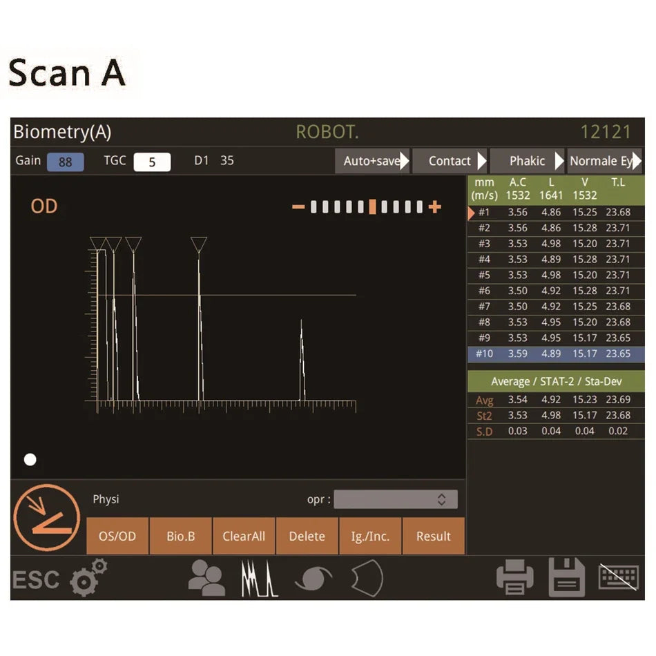 Advanced Ophthalmic Ultrasound Scanner: A/B I Optical AB Scan Testing ...
