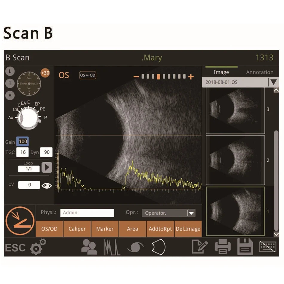 Advanced Ophthalmic Ultrasound Scanner: A/B I Optical AB Scan Testing ...
