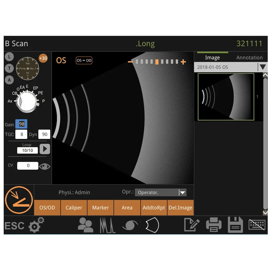 Advanced Ophthalmic Ultrasound Scanner: A/B I Optical AB Scan Testing ...